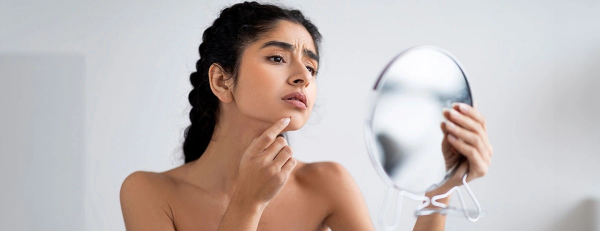 Pickel ausdrücken oder nicht? Zwei Hautexpertinnen klären auf.